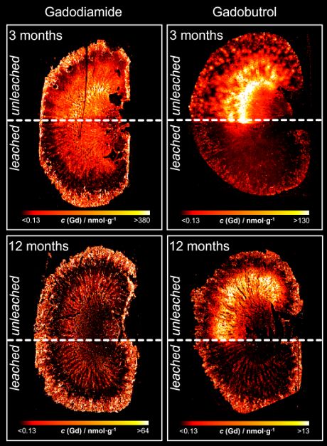 Combined speciation analysis and elemental bioimaging provides new ...